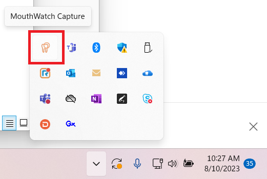 How-To set up Mouthwatch Cameras