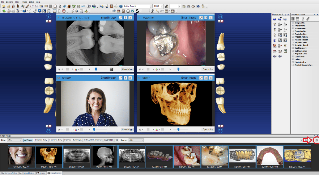 How-To Configure the Dentrix Smart Image Bridge